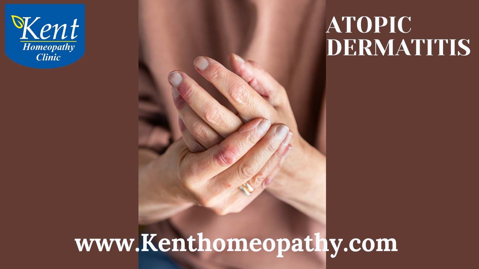 Atopic Dermatitis | Kenthomoepathy | Powai | Mumbai - Homeopathy Doctor ...