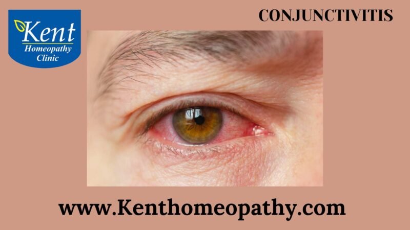 Conjunctivitis | Kenthomoepathy | Powai | Mumbai - Homeopathy Doctor ...
