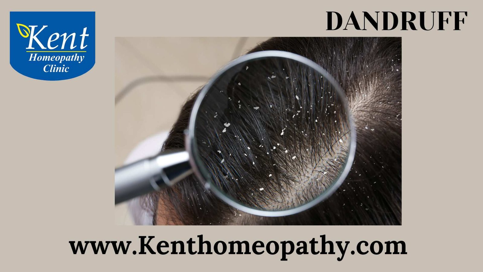 Dandruff/Scaling of the Scalp | Kenthomoepathy | Powai | Mumbai ...