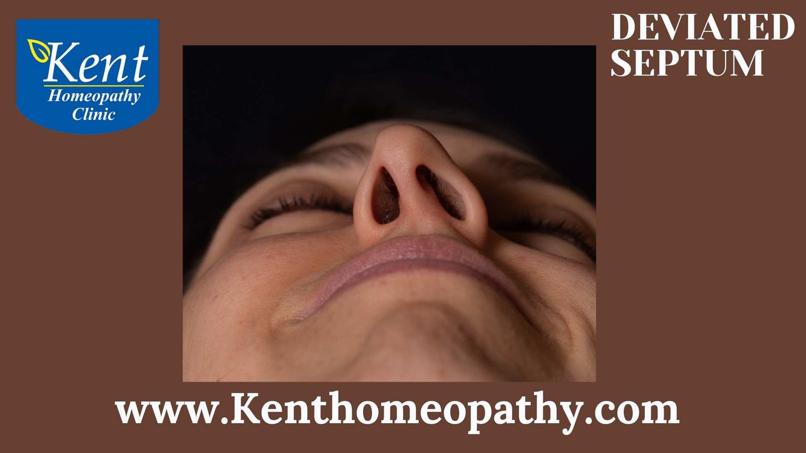 Deviated Septum | Kenthomoepathy | Powai | Mumbai - Homeopathy Doctor ...