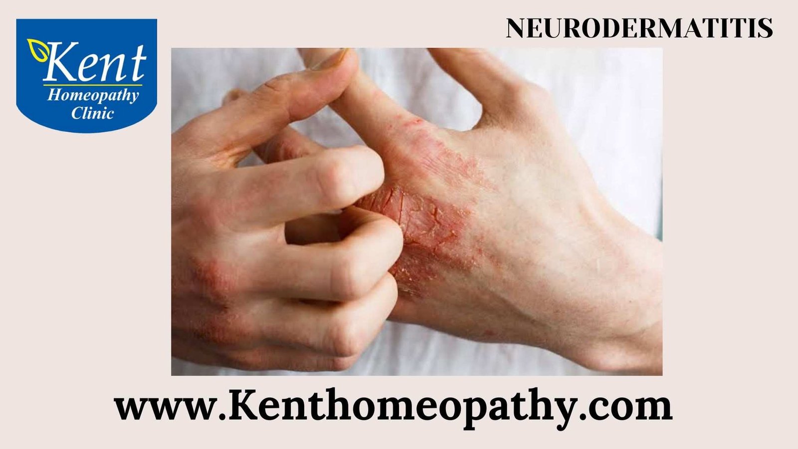 Neurodermatitis | Kenthomoepathy | Powai | Mumbai - Homeopathy Doctor ...