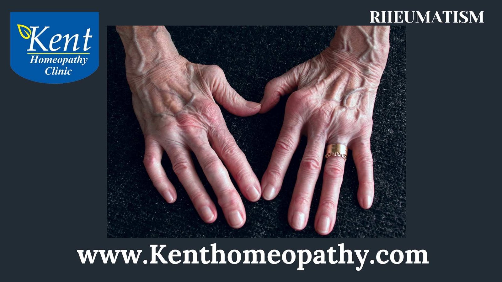 Rheumatism | Kenthomoepathy | Powai | Mumbai - Homeopathy Doctor ...